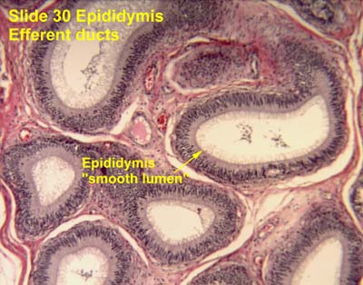 Labeled Epididymis Microscope Slide